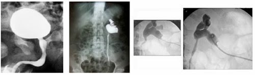 RADIOLOGÍA UROLOGICA : Técnicas de Diagnostico