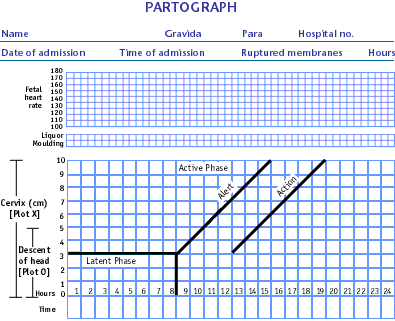 SafebirthUganda: Using the Partograph to improve maternal health in uganda