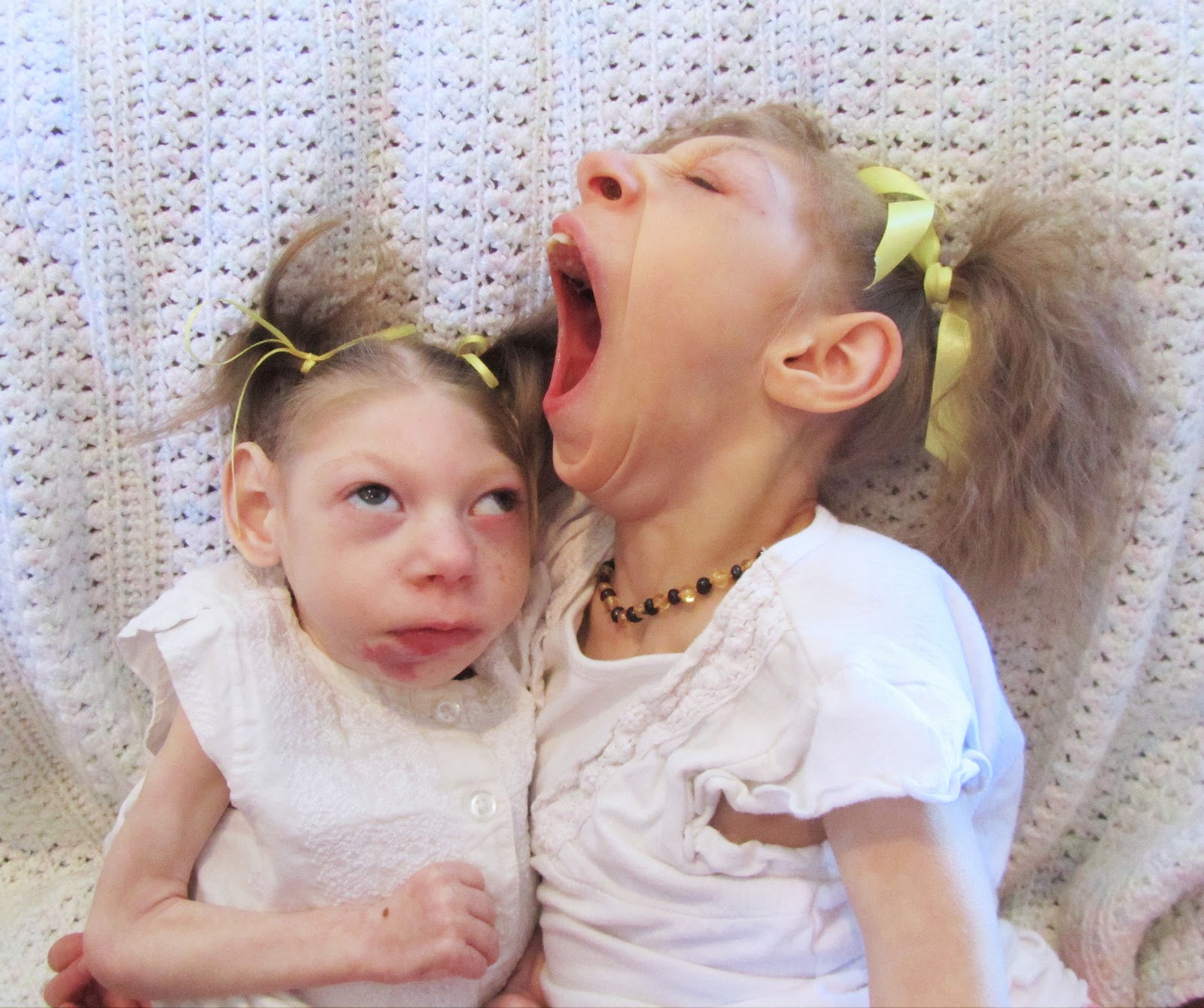 The Hartley Hooligans: Yellow