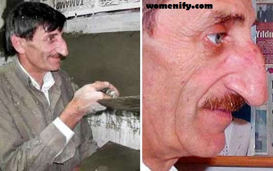 One Turk man left the world record for biggest nose! | Womenify