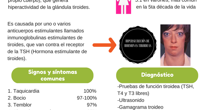DIVULGACIÓN CIENTÍFICA UG: Enfermedad de Graves-Basedow