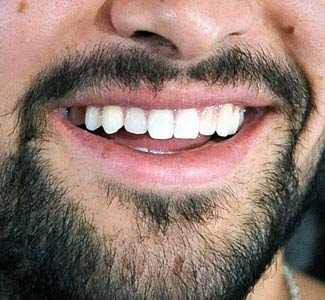 Top Famous Smiles - Pix Magazine