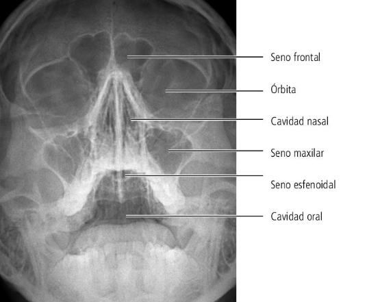 CRANEO-RX FRONTO-MENTO