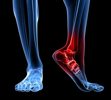 Obat Radang Sendi Pergelangan Kaki ~ Obat Bronkitis Pada Anak