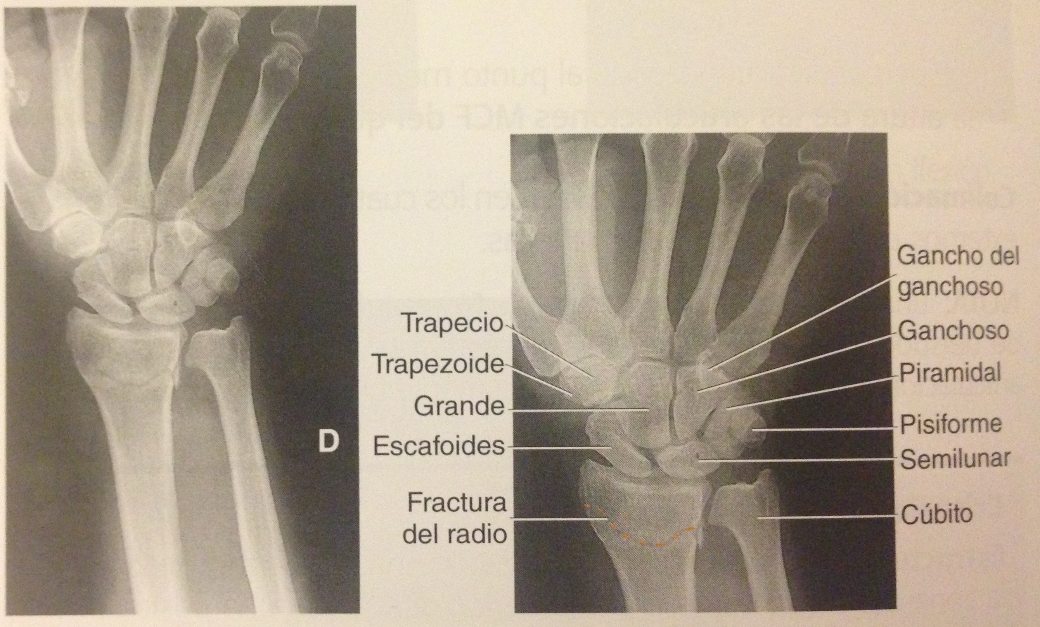 NOSOLOTECNICOS: MUÑECA PA