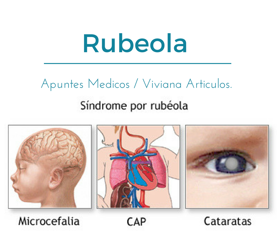 Rubeola.