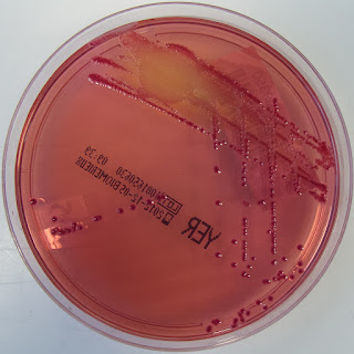 YERSINIA SPP. - Microbiology Laboratory Turkey