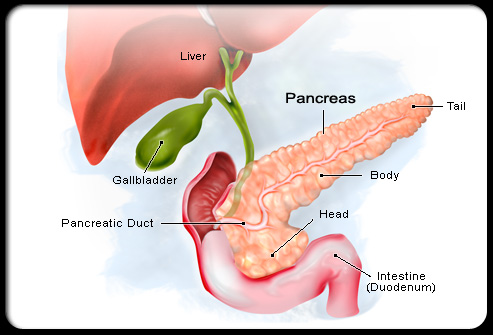 Dr Mat: Pancreatic cancer has been called a "silent" disease because ...