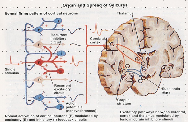 PUBLIC HEALTH: CLINICAL ASPECT OF PARTIAL EPILEPSY