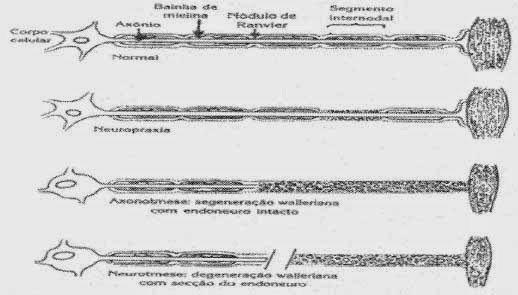 Maisfisio Cursos de Terapia Manual: Saiba tudo sobre Nervo Periférico