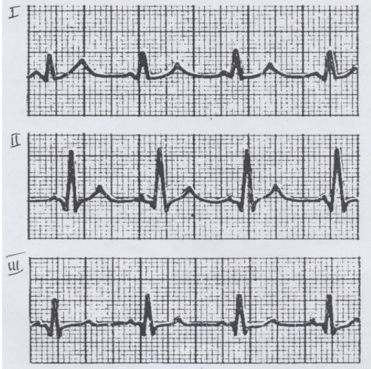 EKG dan Ilmu Dasarnya