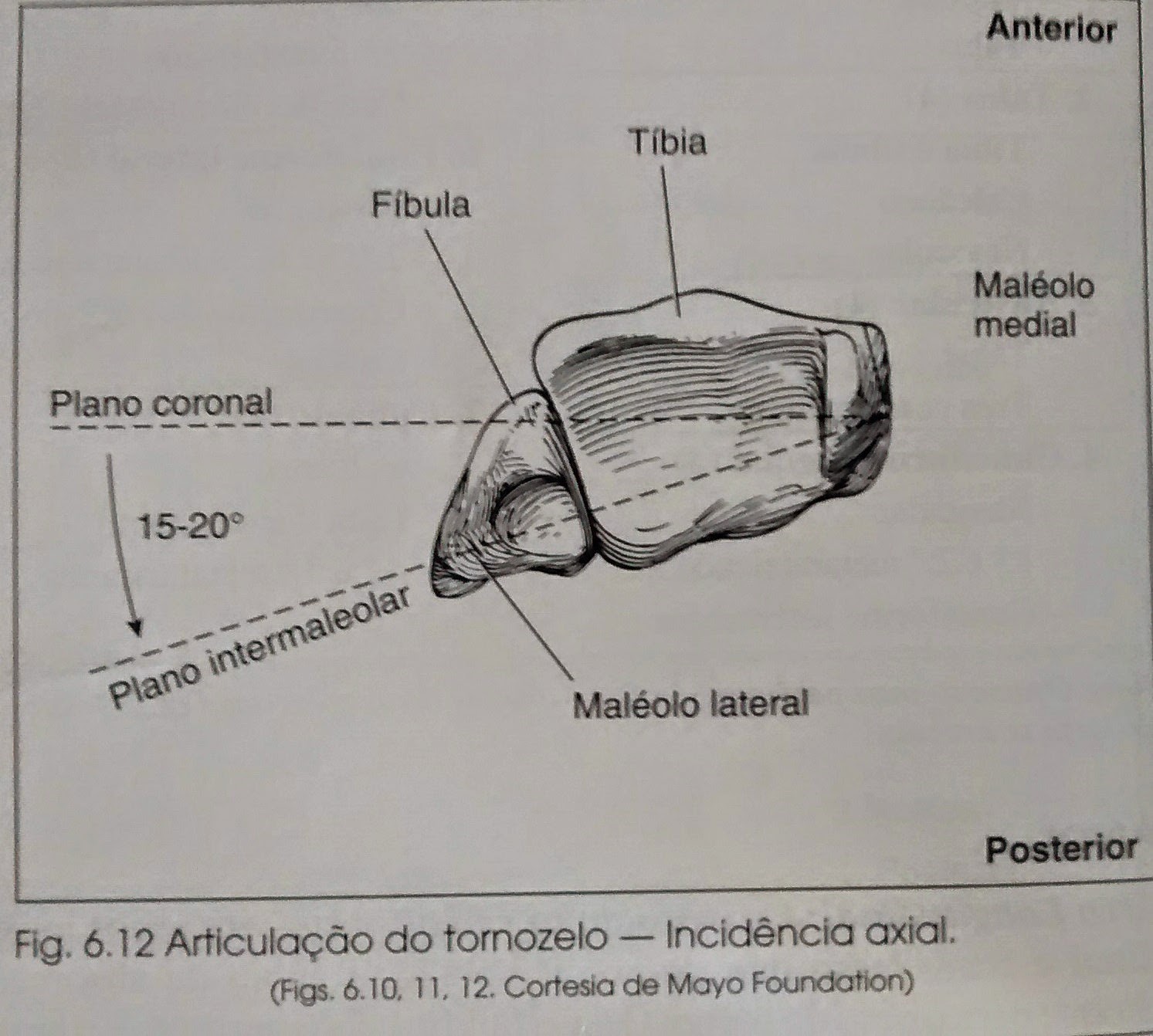 Radiologia Nossa Vida !: ARTICULAÇÃO DO TORNOZELO