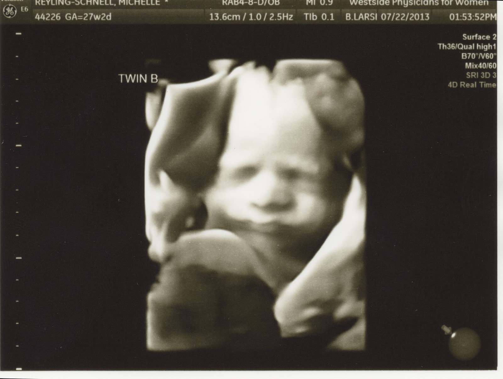 Schnell Family Blog: 27 week ultrasound