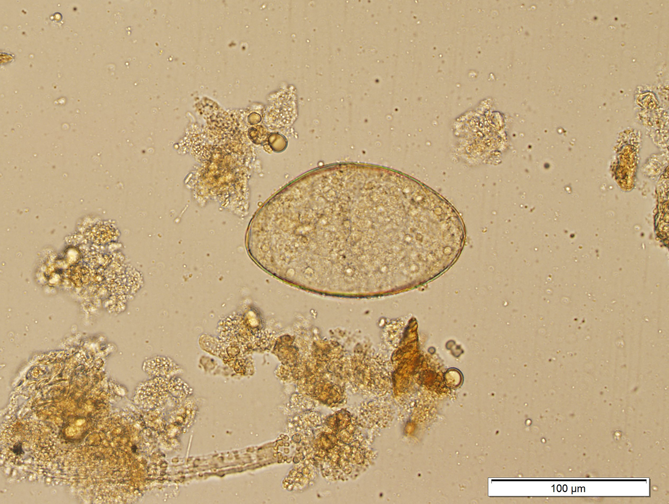 Creepy Dreadful Wonderful Parasites: Case of the Week 366