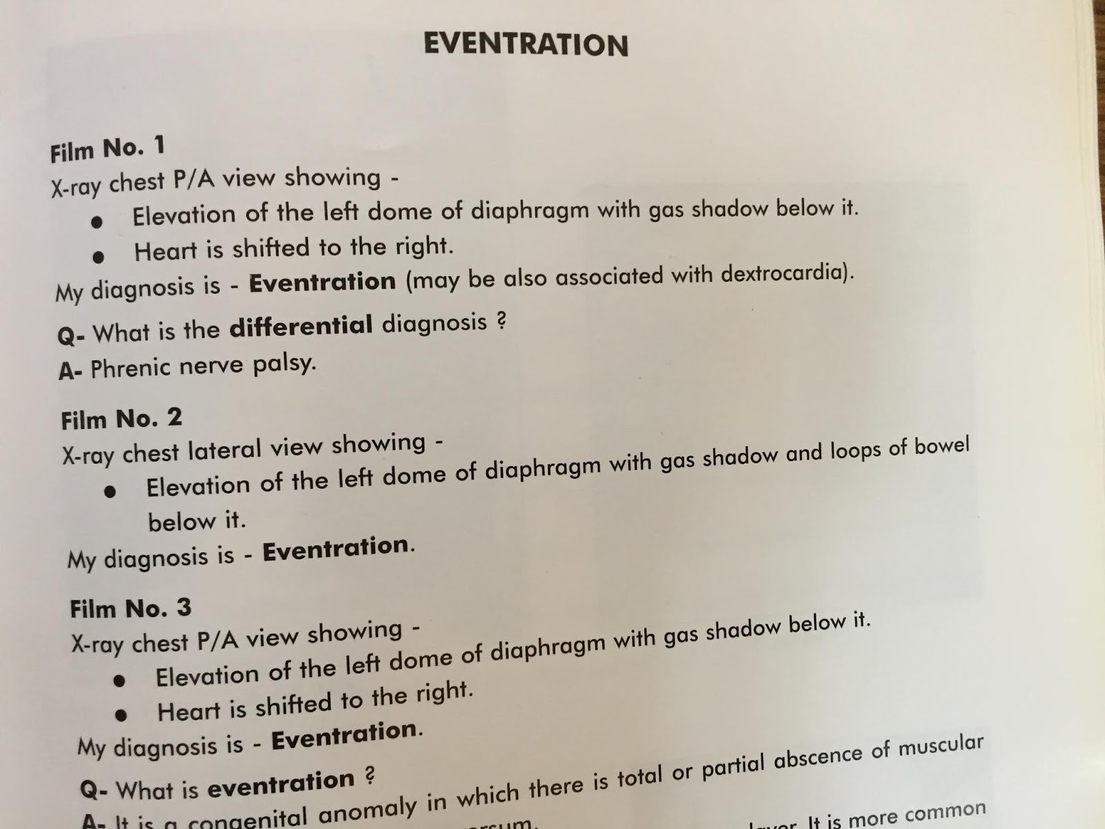 XRAYS OF EVENTRATION