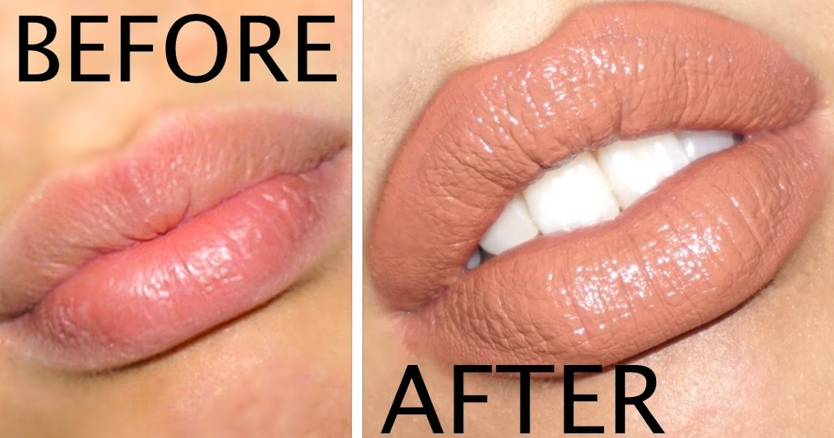 How to Make Your Lips Bigger Naturally?