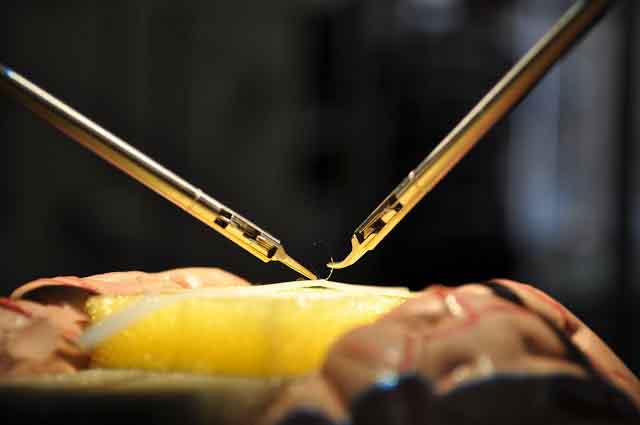 An Enthusiast's Blog ...: Neurological Needles