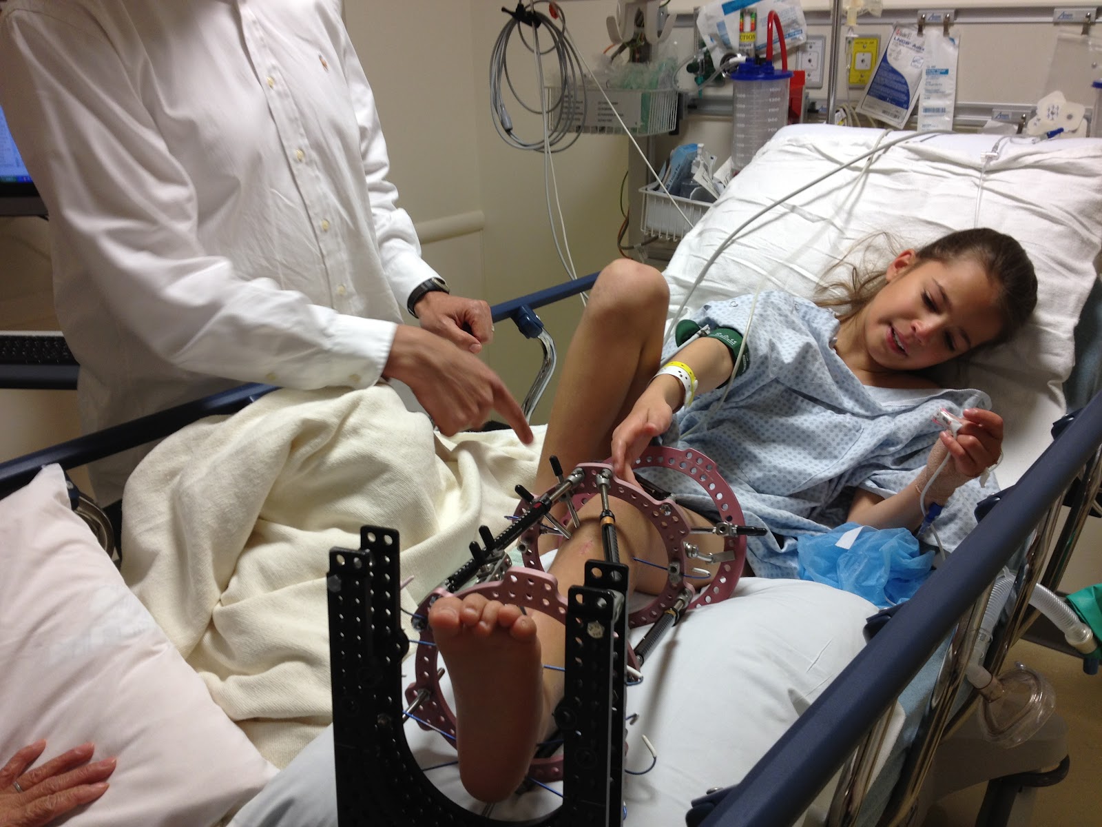 fibular hemimelia leg lengthening: Manipulation (Wiggle) Procedure