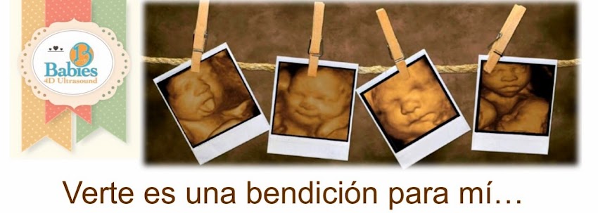 Sonogramas para embarazadas: Babies 3D/4D Ultrasound Puerto Rico