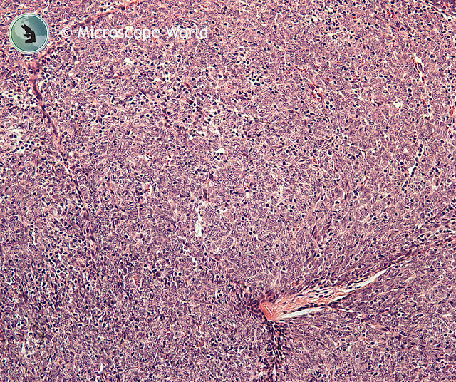 Microscope World Blog: Tissue Biopsy under the Microscope