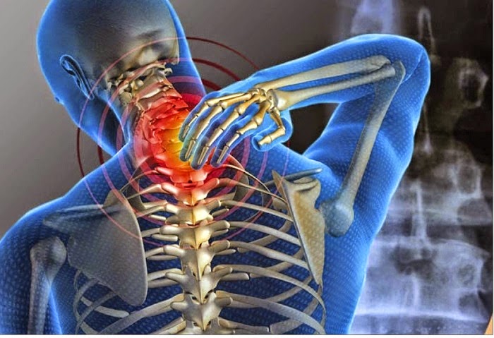 How to remove contractures? - Workout War Training