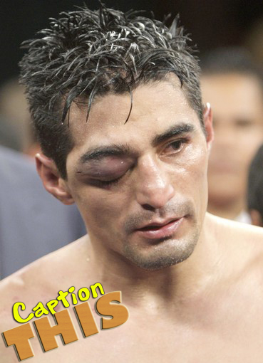 A Mom's Thoughts on Sports and a Black-eye