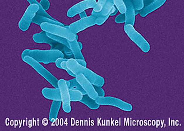 Membangun Kesehatan Hewan Untuk Kesehatan Manusia: SHIGELLOSIS ...