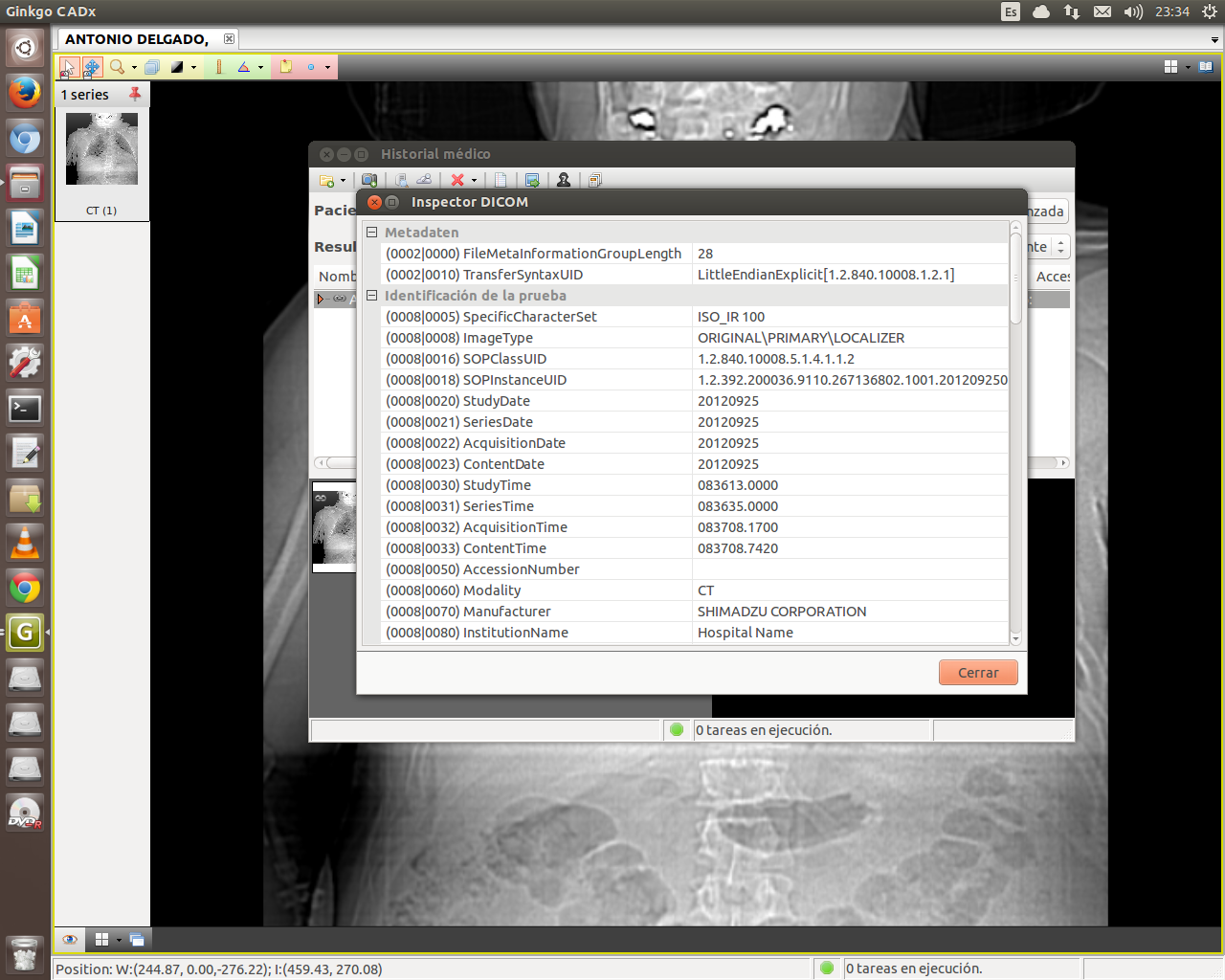 La Web Del Yuyo: Editar y visualizar archivos con extension DCM (DICOM ...