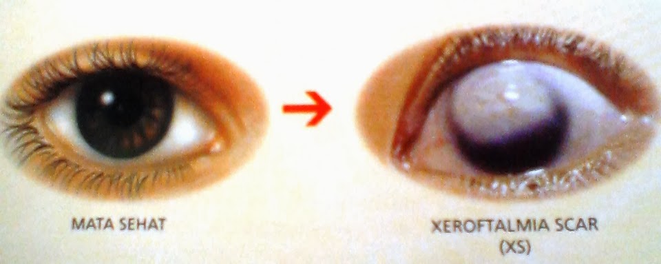 Seputar Kesehatan: SEPUTAR KESEHATAN