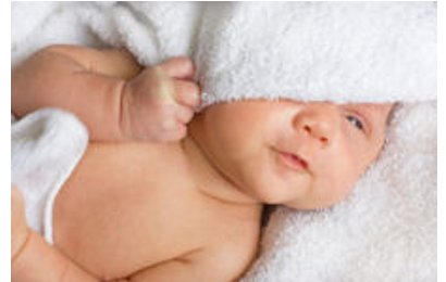 Sulistia Rini: Penyebab Bayi Lahir Cacat