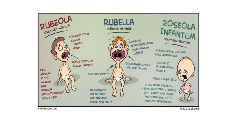 Doctor Kid: Lecții de pediatrie pentru părinți: Comparaţie rujeola ...