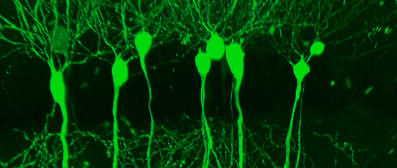 Karl Deisseroth Explains CLARITY, The Method That Allows Brains To ...