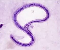 PARASITOLOGÌA - P4 - JOSÈ YENCHONG: ONCOCERCOSIS