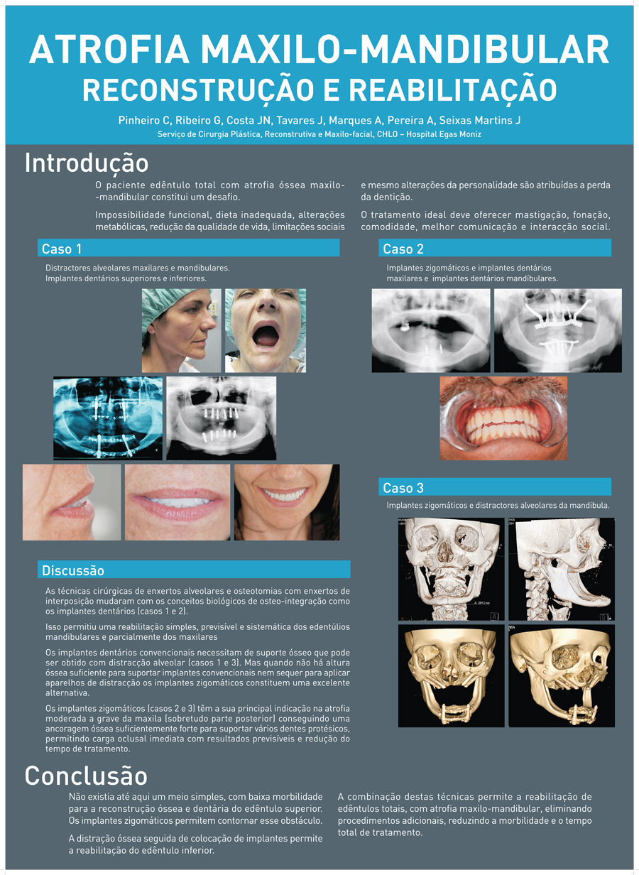 Como Fazer um Banner para Congresso Científico: Pôster para Odontologia ...