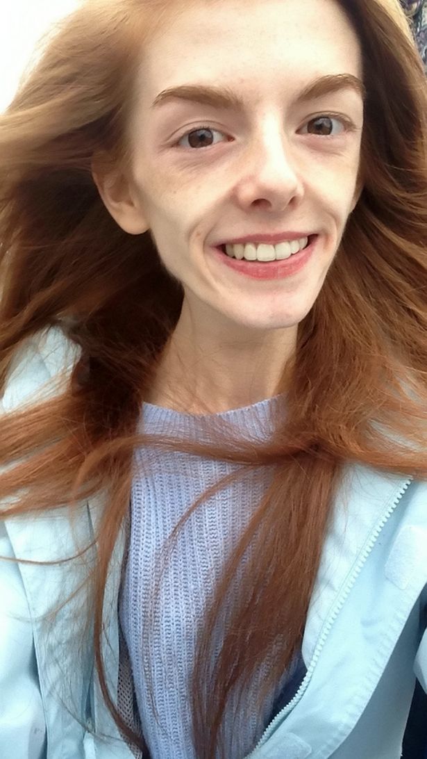 Anorexic Woman Was Transformed And Saved By Chocolates. - The Daily ...