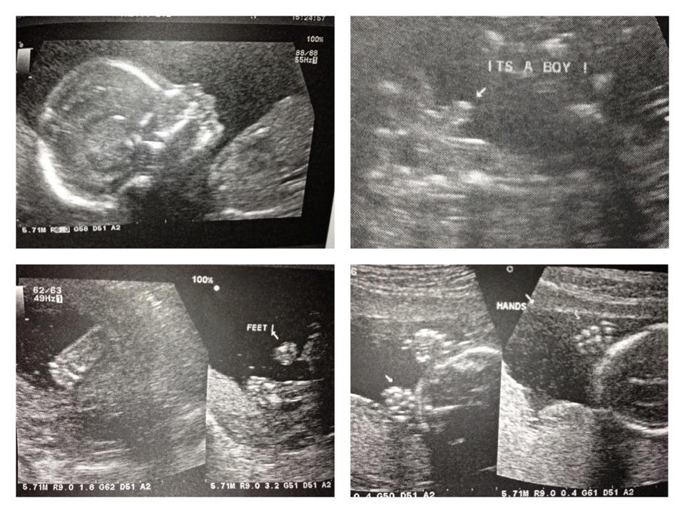 We were all made beautifully: 20-21 weeks pregnancy update