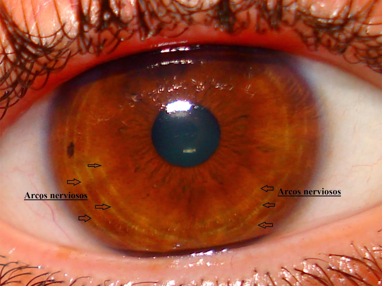 La Iridología la ciencia de diagnosticar tu salud por el iris: Los ...