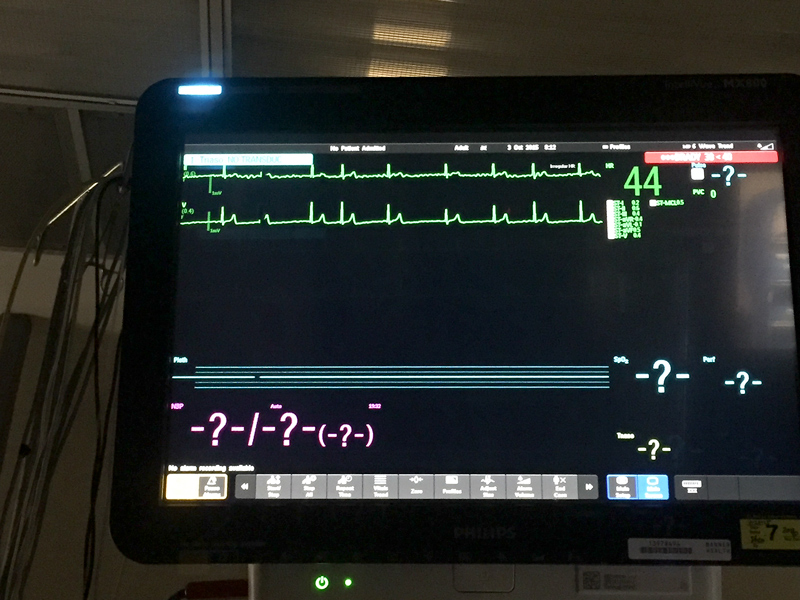 ENDORPHINS FOR BREAKFAST: Atrial Bleeping Fibrillation, Part I