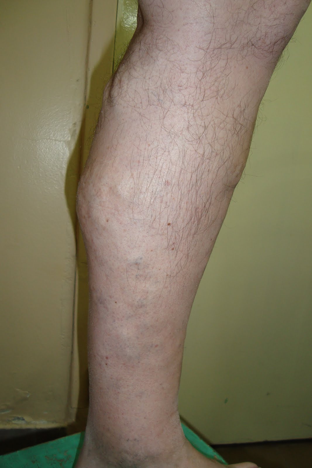 Cursos de Cirugía - Hospital Tornú: agosto 2011