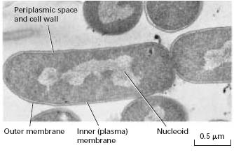 Difference between Prokaryotic cell and Eukaryotic cell