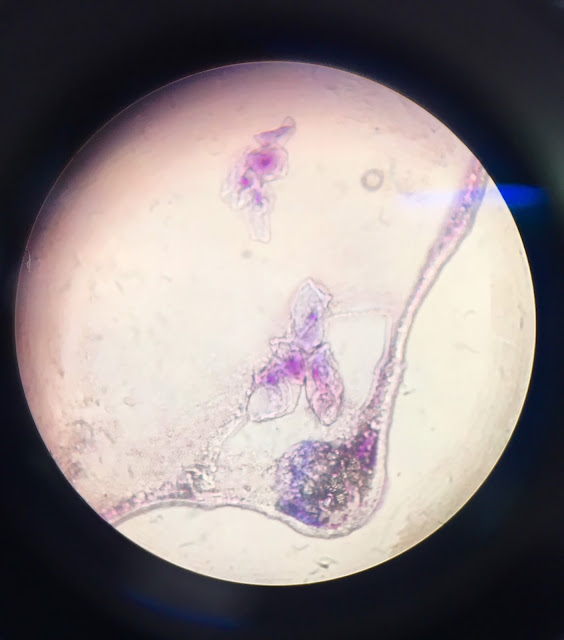 VIENDO CÉLULAS ANIMALES Y VEGETALES A TRAVÉS DEL MICROSCOPIO