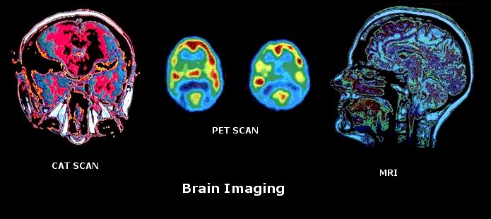 Types of CT scan ~ Comparative Sciences