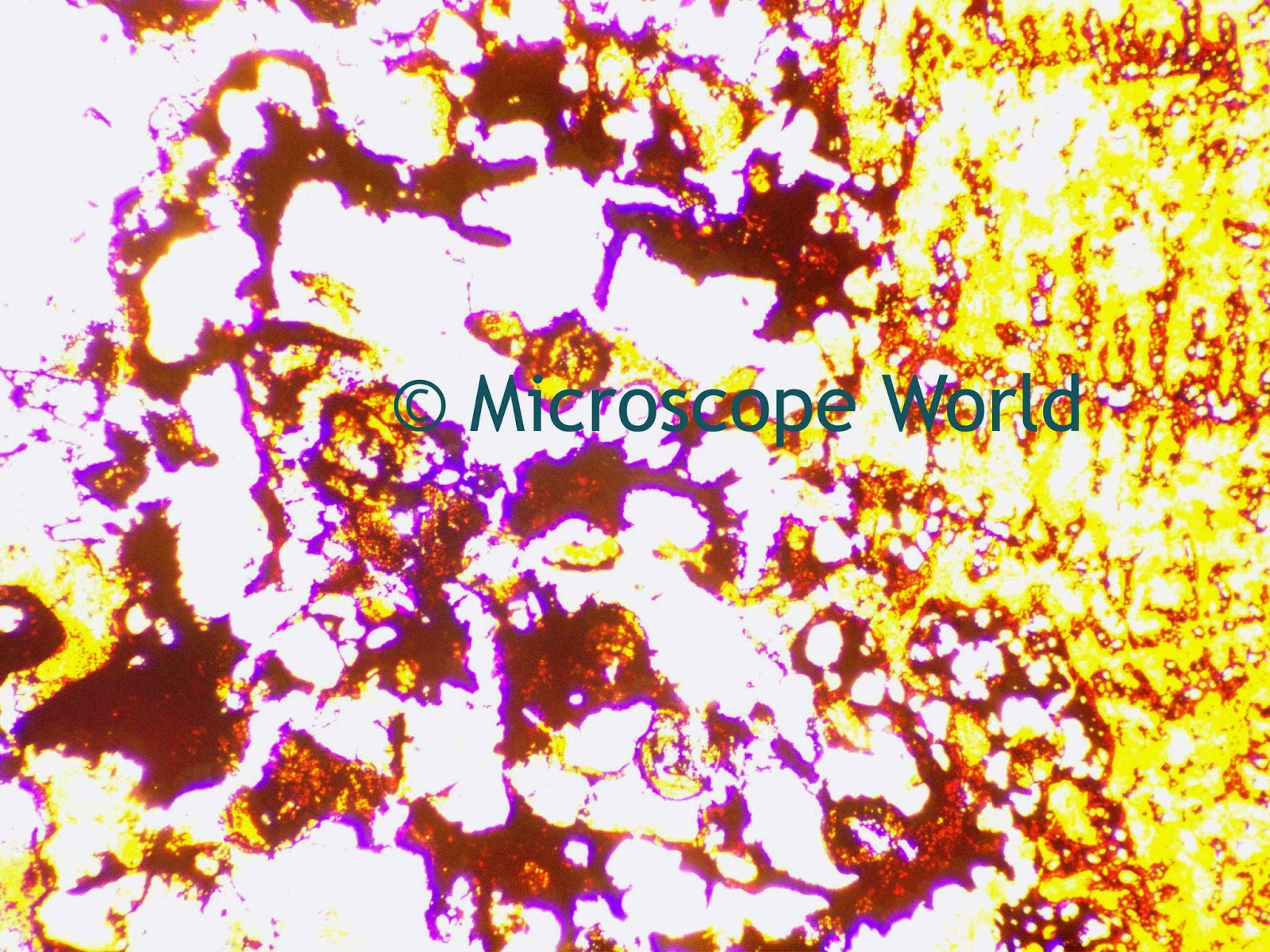 Microscope World Blog: Tuberculosis under the Microscope