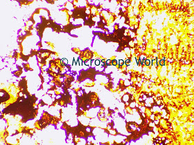 Microscope World Blog: Tuberculosis under the Microscope