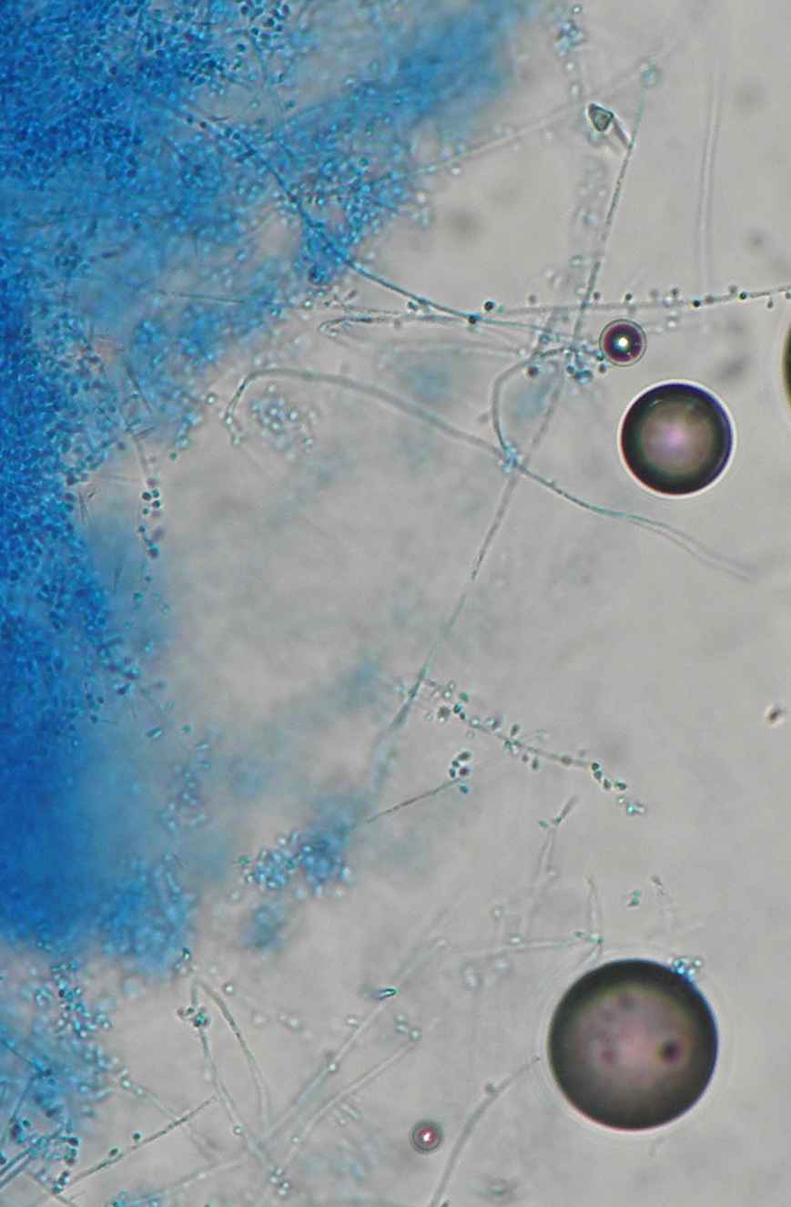 ATLAS MICOLOGIA: TRICHOPHYTON RUBRUM