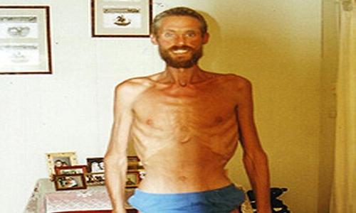 5 Most Amazing Survival Stories