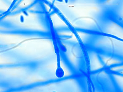 Fun With Microbiology (What's Buggin' You?): Sepedonium species