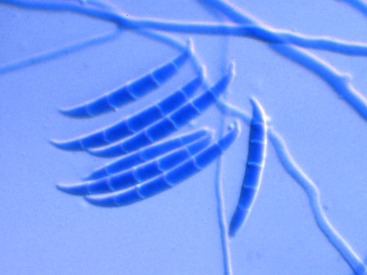 Microbiología y Epidemiología: Fusarium sp.