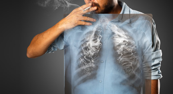 How To Clean Tar Out Of Your Lungs Airlines Celebrates