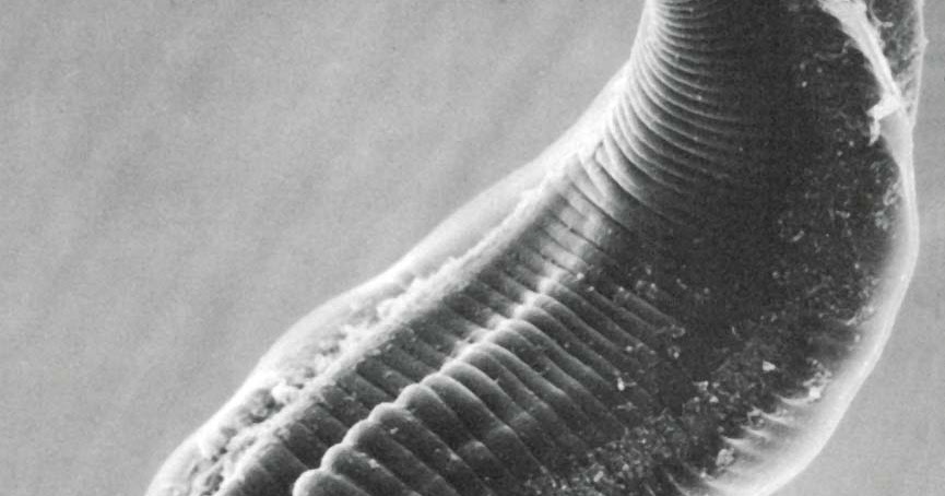 dr.Lestari Rahmah, MKT: CACING KREMI